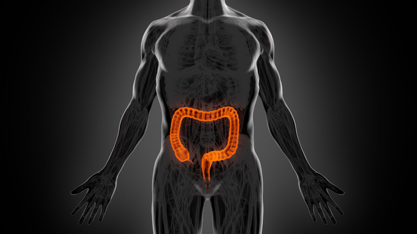 Intestine Surgery – Pranic Healing