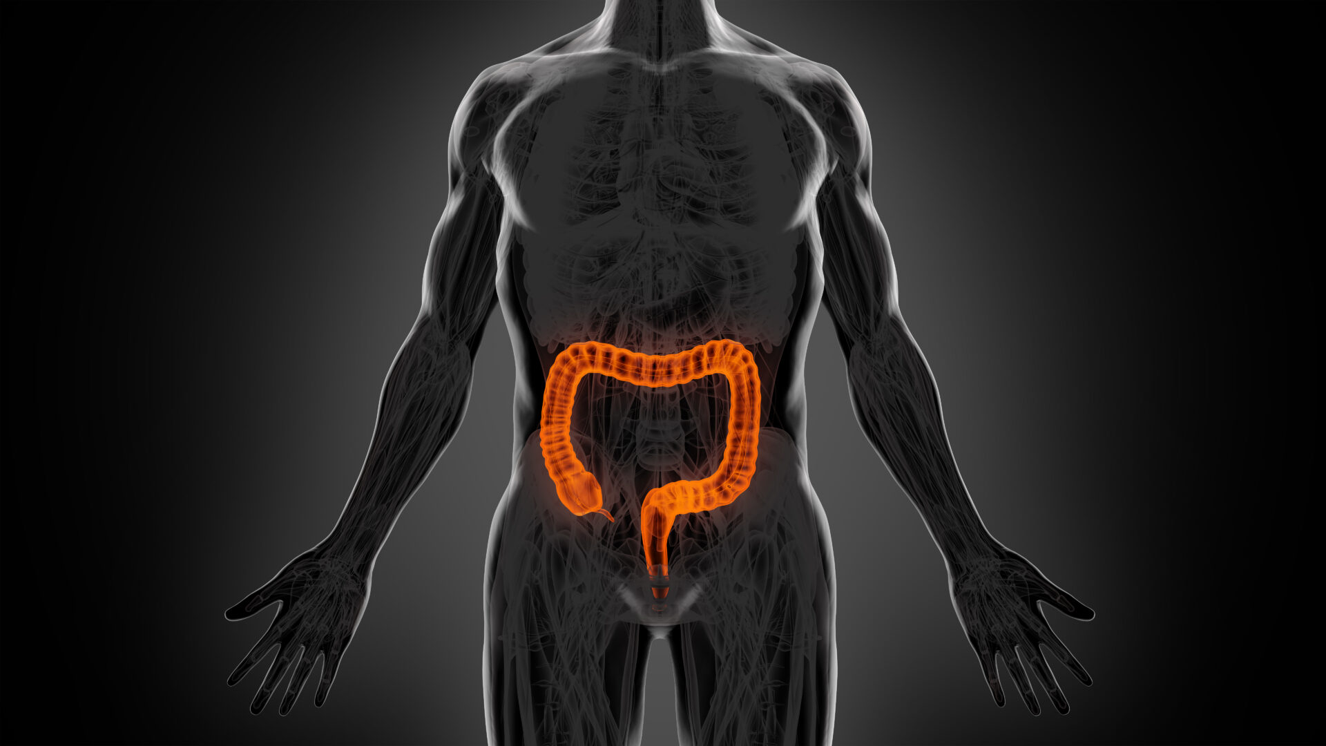 Intestine Surgery – Pranic Healing